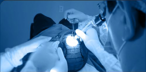 Clínica Speranzini - Especializada em Transplante Capilar em SP